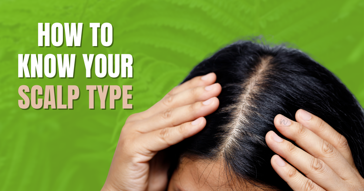 How to know your scalp type – Nature4Nature